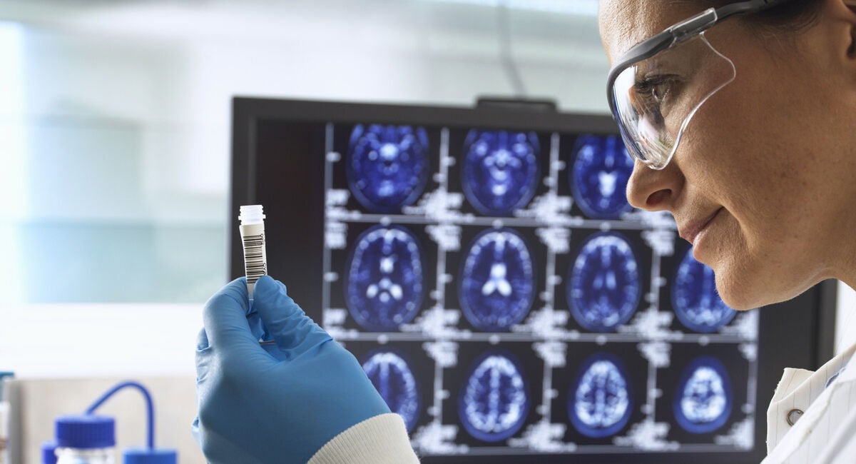 Trends In Neuroscience Drug Discovery And Development | L.E.K. Consulting